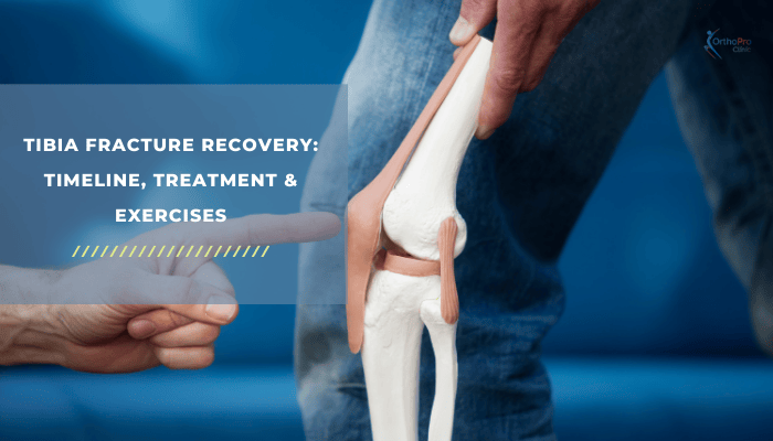 Patellar Tendonitis Treatment: Week-by-Week Recovery Guide
